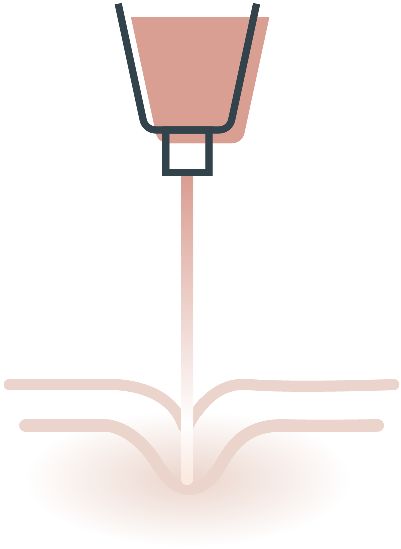 Fractional Laser with the Experts at Anue