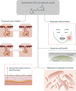 Isotretinoin: The Definitive Guide by Anue
