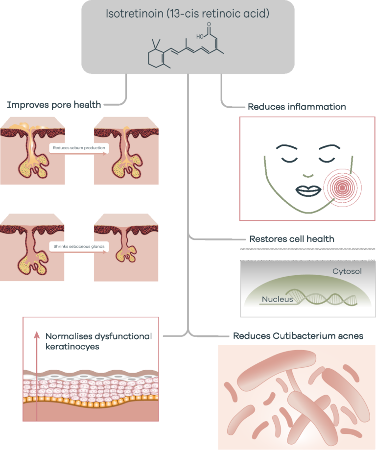 Isotretinoin: The Definitive Guide by Anue